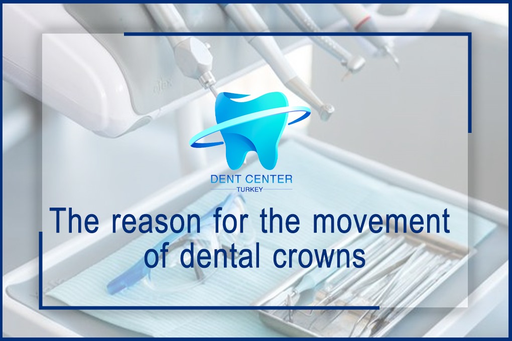 Cause of Moving Dental Crown - DentCenterTurkey