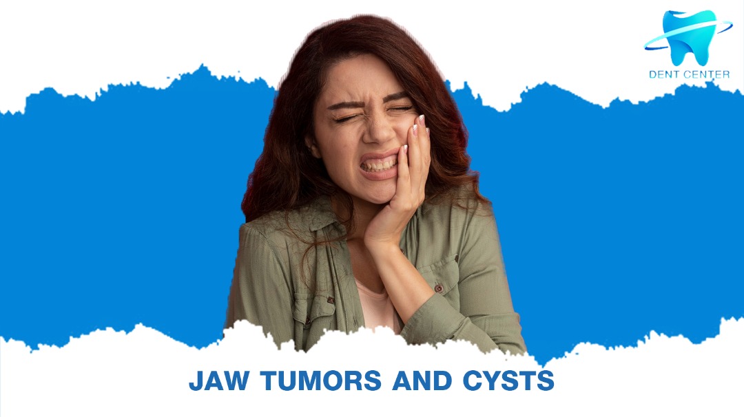 Jaw Tumors and Cysts - DentCenterTurkey