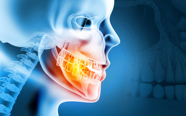 Early Symptoms of Jaw Cancer - DentCenterTurkey