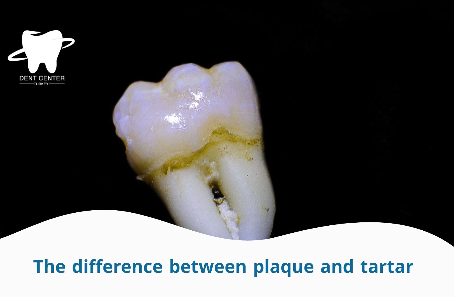 The Difference Between Plaque and Tartar - DentCenterTurkey