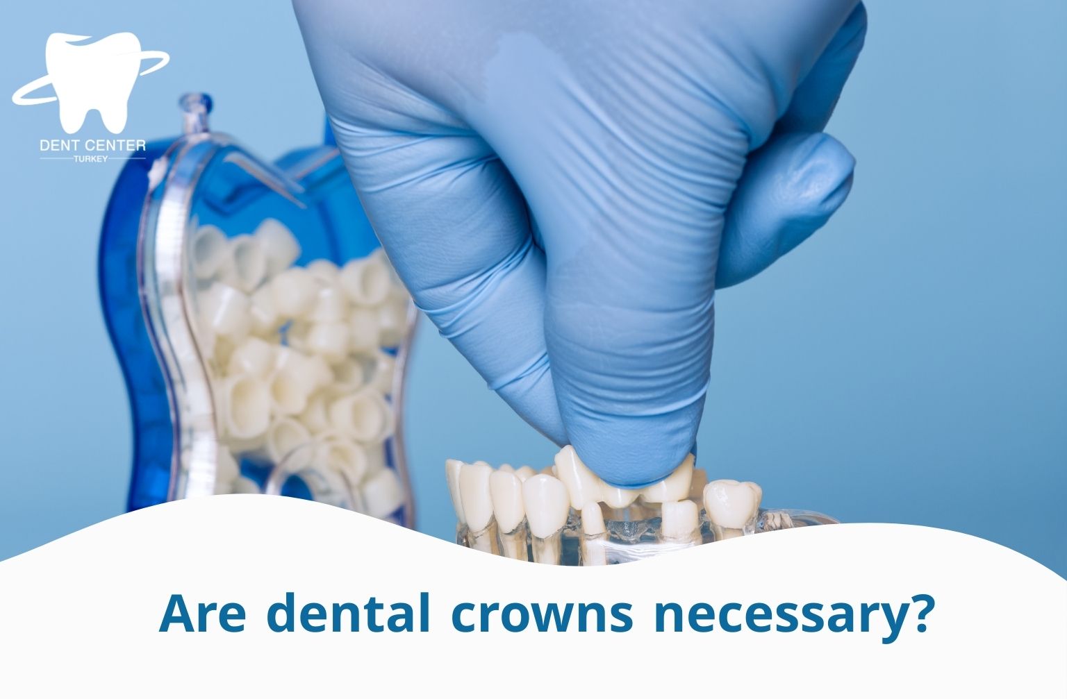 Are Dental Crowns Necessary? - DentCenterTurkey